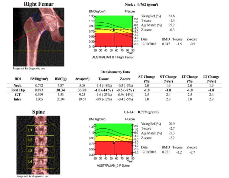 Case Studies : The Bone Clinic